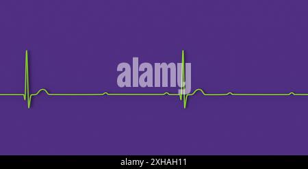 Illustration of an electrocardiogram (ECG) depicting a complete heart ...
