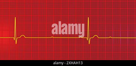 Illustration of an electrocardiogram (ECG) depicting a complete heart ...