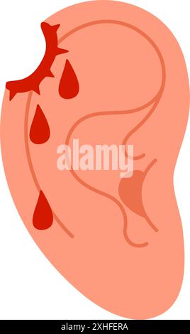 Wounded ear. bullet hole. Injured human ear with blood drops. a sense ...
