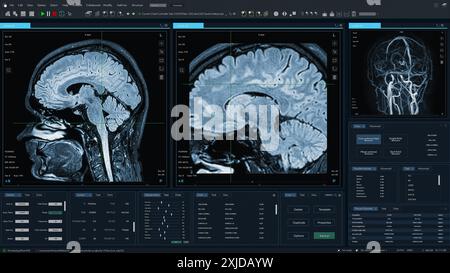 3D Render: Magnetic Resonance Imaging Brain Scan Mock-up with Multiple ...