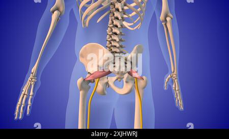 Injecting steroids to treat Piriformis Syndrome Stock Photo - Alamy