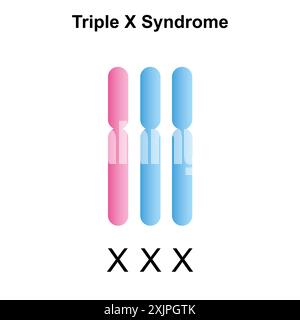 Triple x syndrome, illustration Stock Photo - Alamy