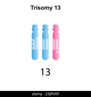 Trisomy 13 syndrome, illustration Stock Photo - Alamy