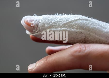 Mallet finger, stack splint on the middle finger with bandage to ...