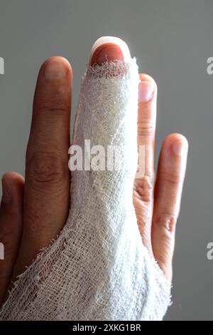 Mallet finger, stack splint on the middle finger with bandage to ...