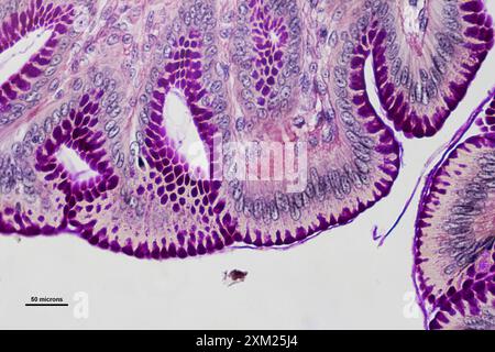 Stomach wall. Light micrograph of a section through the stomach. The ...