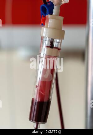 Intensive care unit blood transfusion. Drip chamber (centre) with blood ...