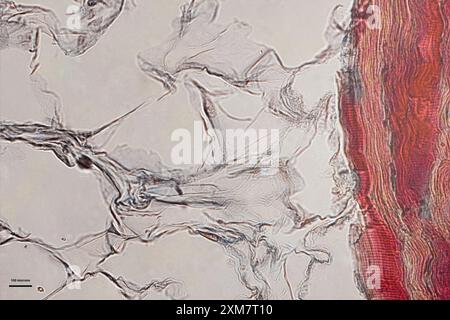 adipose (body fat) tissue under a light microscope times 40 ...