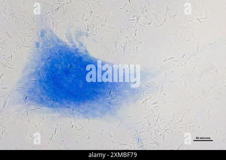 nerve cells under a light microscope at times 10 magnification Stock ...