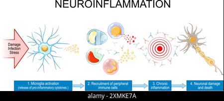 Neuroinflammation. Development of neurodegenerative diseases from ...