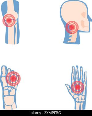 Rheumatism icons set cartoon vector. Human joint with pain ring ...