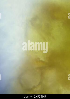 (Lycogala flavofuscum) Protozoa Stock Photo - Alamy