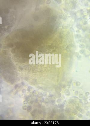 (Lycogala flavofuscum) Protozoa Stock Photo - Alamy
