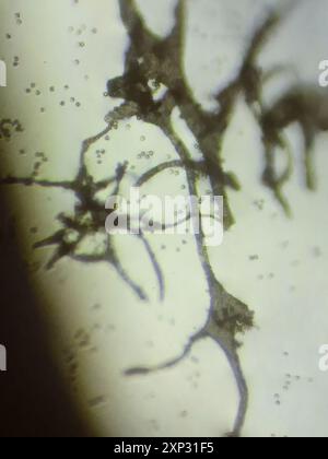 (Lycogala flavofuscum) Protozoa Stock Photo - Alamy