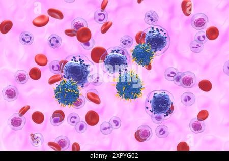 Acute myeloid leukaemia (AML) - isometric view 3d illustration Stock ...