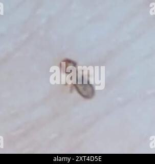 chicken body lice (Menoponidae) Insecta Stock Photo - Alamy