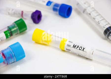 Mpox blood test empty tubes samples on the white background, studio ...