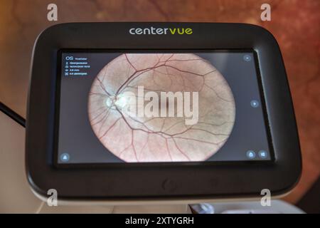 An ultra wide digital retinal scan of a human eye showing the veins and ...