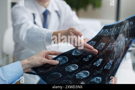 shows the x-ray image to the patient at the reception Stock Photo - Alamy