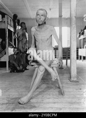 An extremely famished Jewish survivor at Ebensee. Ebensee was a subcamp ...