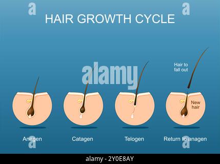 Hair growth cycle from Anagen to Catagen, and Telogen. Poster about ...