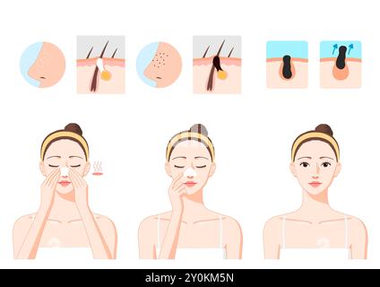 Woman taking care to get rid of skin disease Stock Photo - Alamy