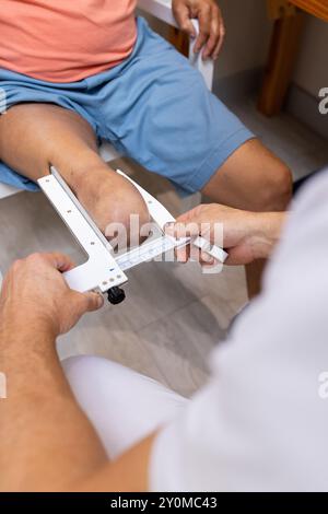 Measuring leg for prosthetic fitting, technician using caliper in lab ...