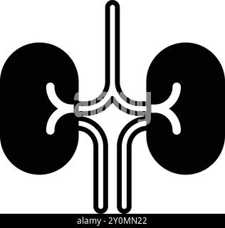 Kidney stone disease. Renal colic. Human Urinary System. Close-up of a ...