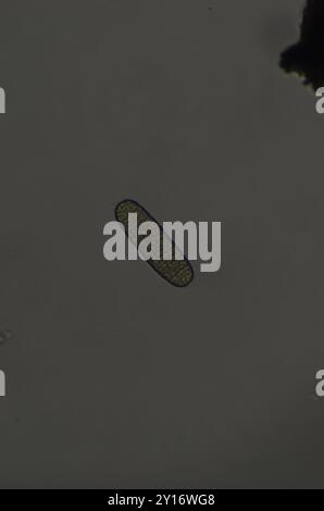 (Lopadium disciforme) Fungi Stock Photo - Alamy