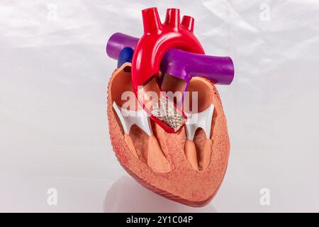 Cardiac model of Transcatheter aortic valve implantation (TAVI) for ...