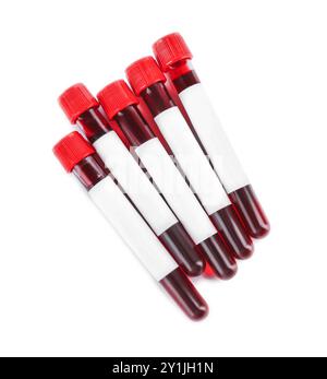 Blood in test tubes with blank labels on white background, top view ...