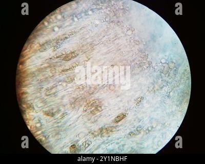 (Trapeliopsis viridescens) Fungi Stock Photo - Alamy