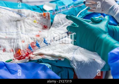 The procedure of inserting a double lumen catheter into a patient with ...