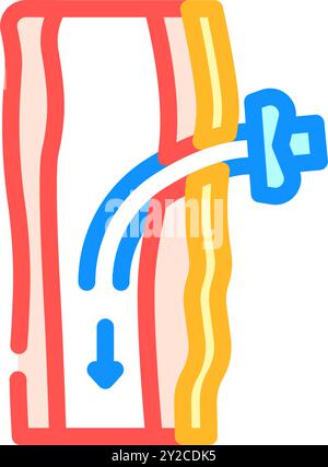 tracheostomy surgery color icon vector. tracheostomy surgery sign ...