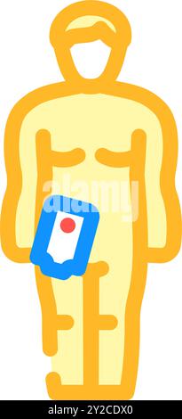 vector medical illustration of an operation of ileostomy Stock Vector ...