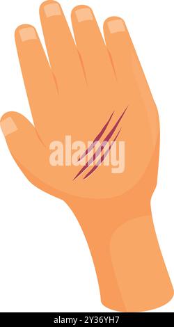 open wound on palm of hand. Traumas of skin on body part. Vector ...