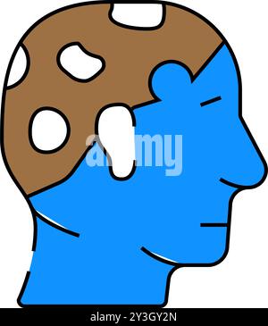 alopecia areata color icon vector illustration Stock Vector Image & Art ...