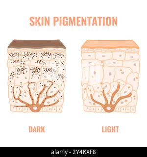 Human skin tone pigmentation diversity infographic diagram Stock Vector ...
