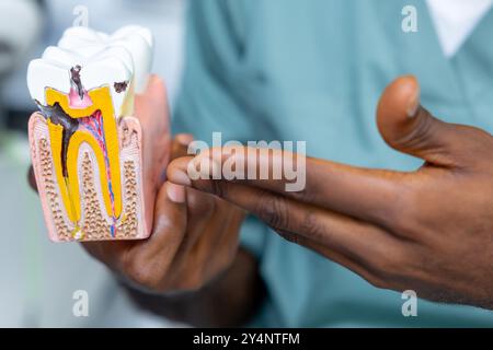 Dental model illustrating tooth decay on the exterior surface and a ...
