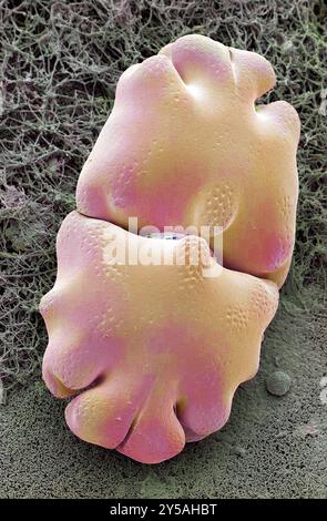 Scanning Electron Micrograph (SEM) of the desmid (green algae) species ...