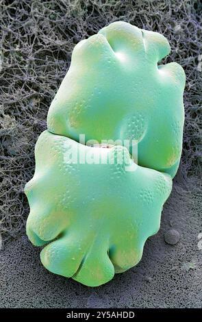 Euastrum desmid. Scanning electron micrograph (SEM) of a Euastrum ...