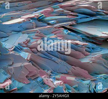 Gallbladder surface, coloured scanning electron micrograph (SEM). At ...