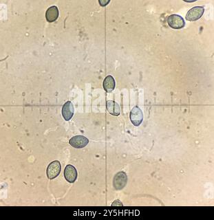 (Podospora araneosa) Fungi Stock Photo - Alamy