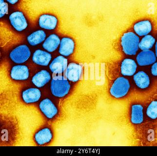 Colorized transmission electron micrograph of mpox virus particles ...