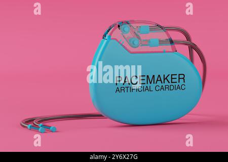 Implantable Pink Artificial Cardiac Pacemaker Device in Duotone Style ...