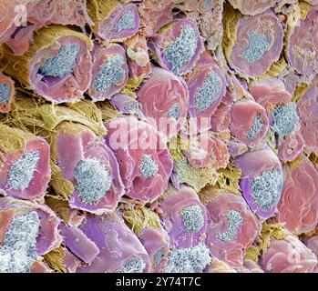 Nerve cells. Coloured scanning electron micrograph (SEM) of nerve cells ...