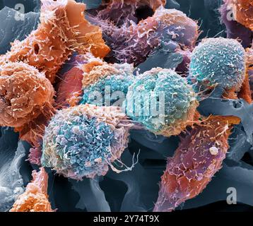 HeLa cells, SEM Stock Photo - Alamy