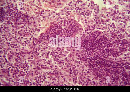 A section trough lymph node cells under the microscope Stock Photo - Alamy