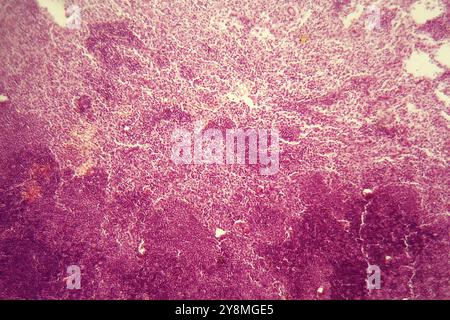 Lymph node under the microscope Stock Photo - Alamy