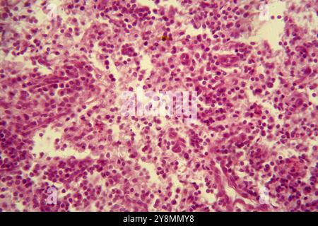 A section trough lymph node cells under the microscope Stock Photo - Alamy